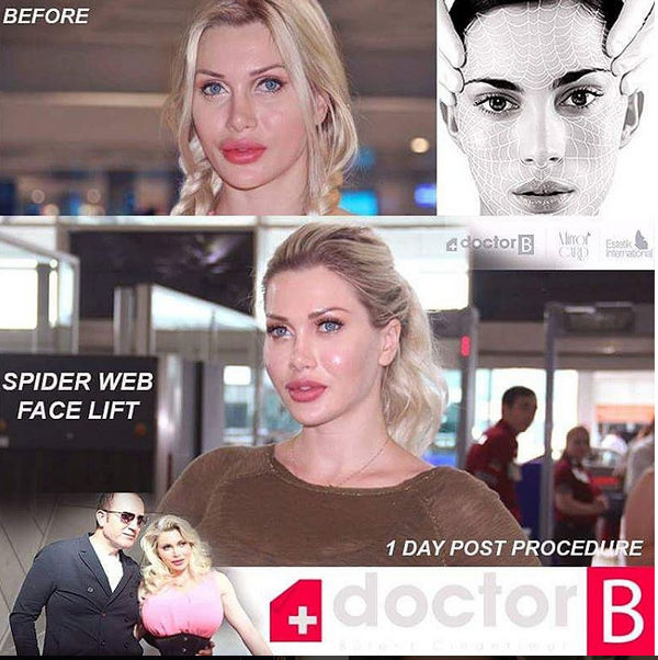 Jessica Rabbit’e benzemek isteyen Pixee Fox Türkiye’ye geliyor