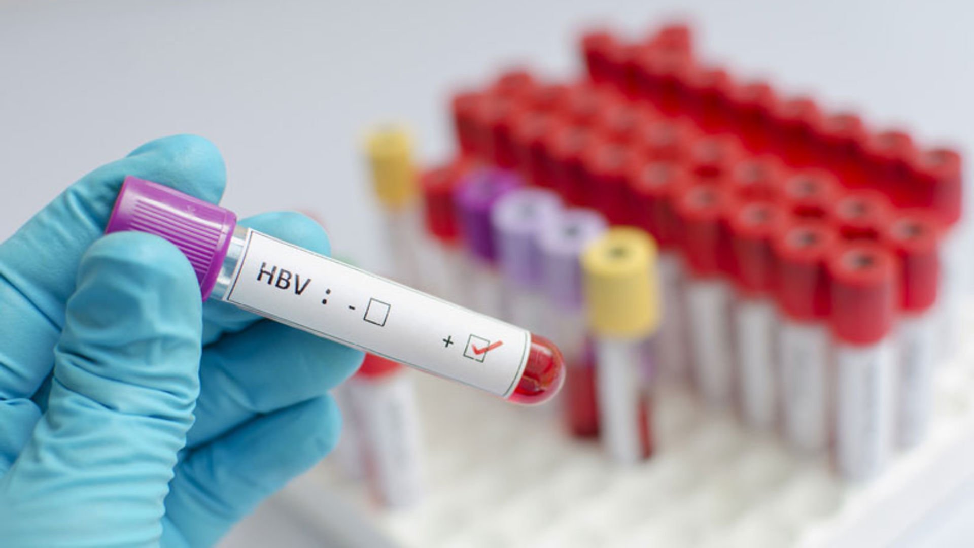 Hepatit nedir? | Sağlık