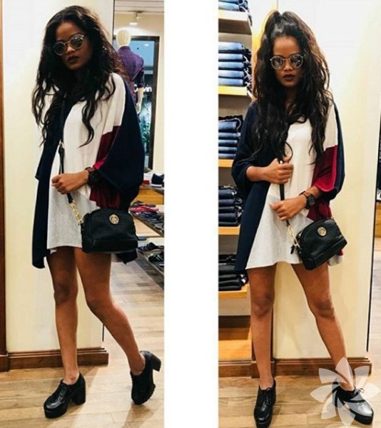 Rihanna'ya benzeyen model: Renee Kujur | Yaşam